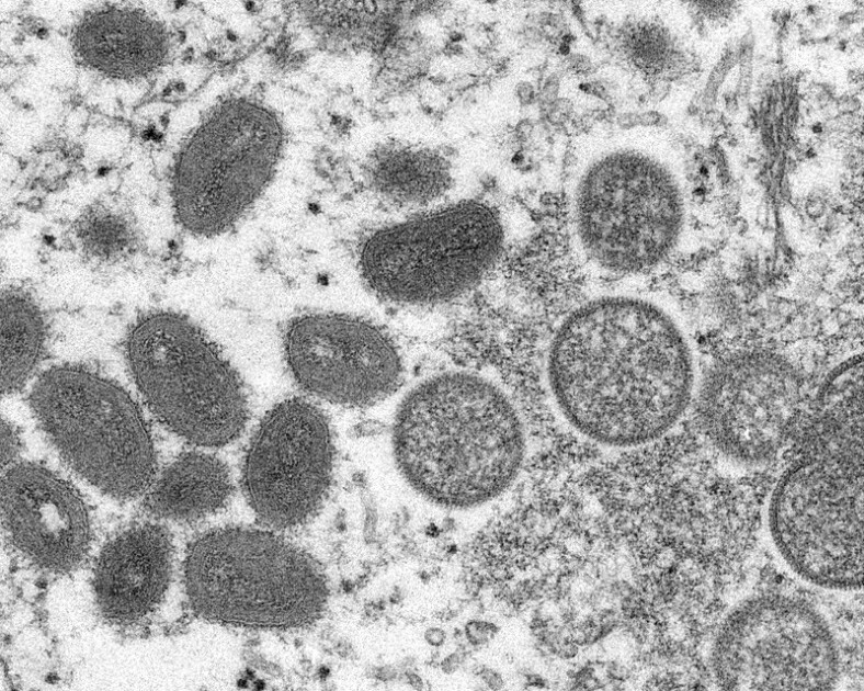 Frequently Asked Questions about Mpox | Institute of Tropical Medicine