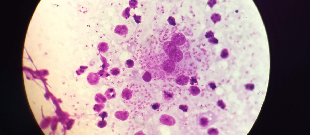 Unlocking the secrets of Leishmania | Institute of Tropical Medicine