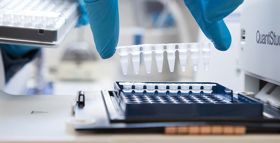 Monkeypox PCR tests now at ITM | Institute of Tropical Medicine