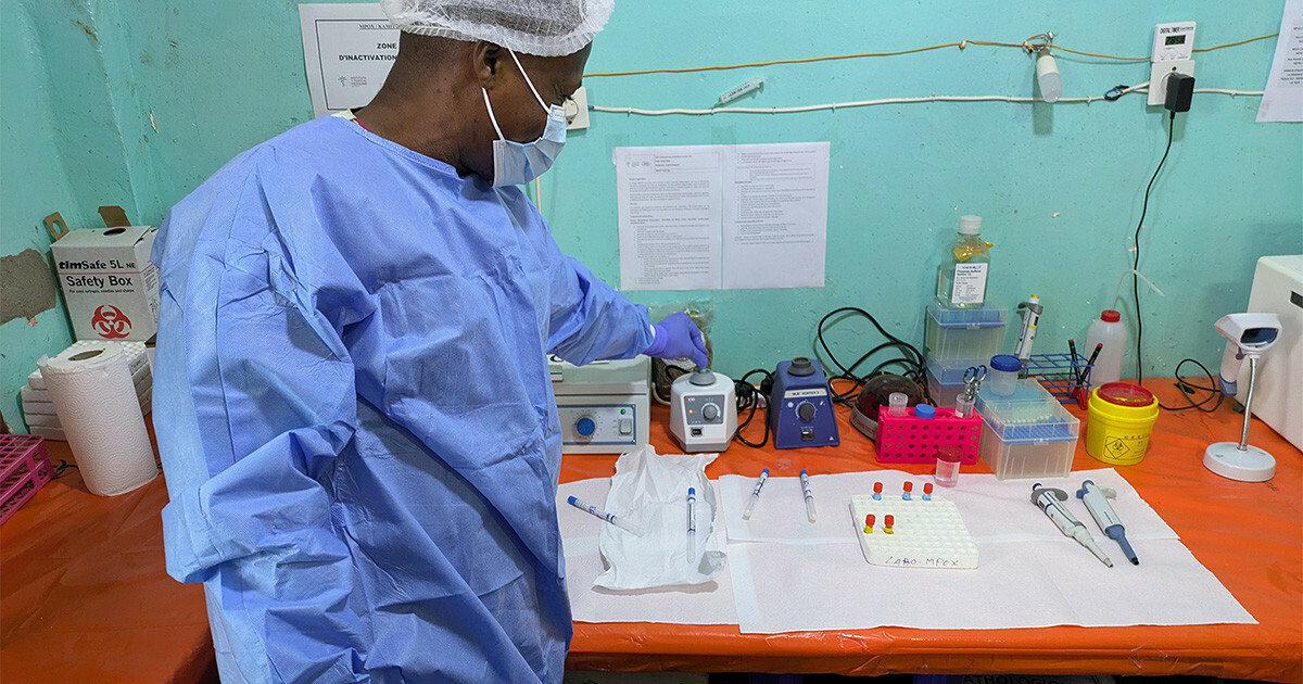 Largest study of its kind reveals new insights into Clade Ib of mpox ...