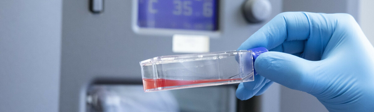 Research | Institute of Tropical Medicine