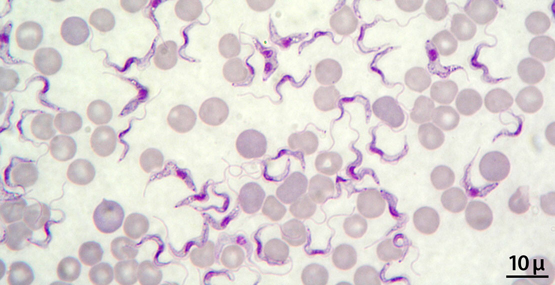 Des parasites non détectables compliquent l'élimination de la maladie ...