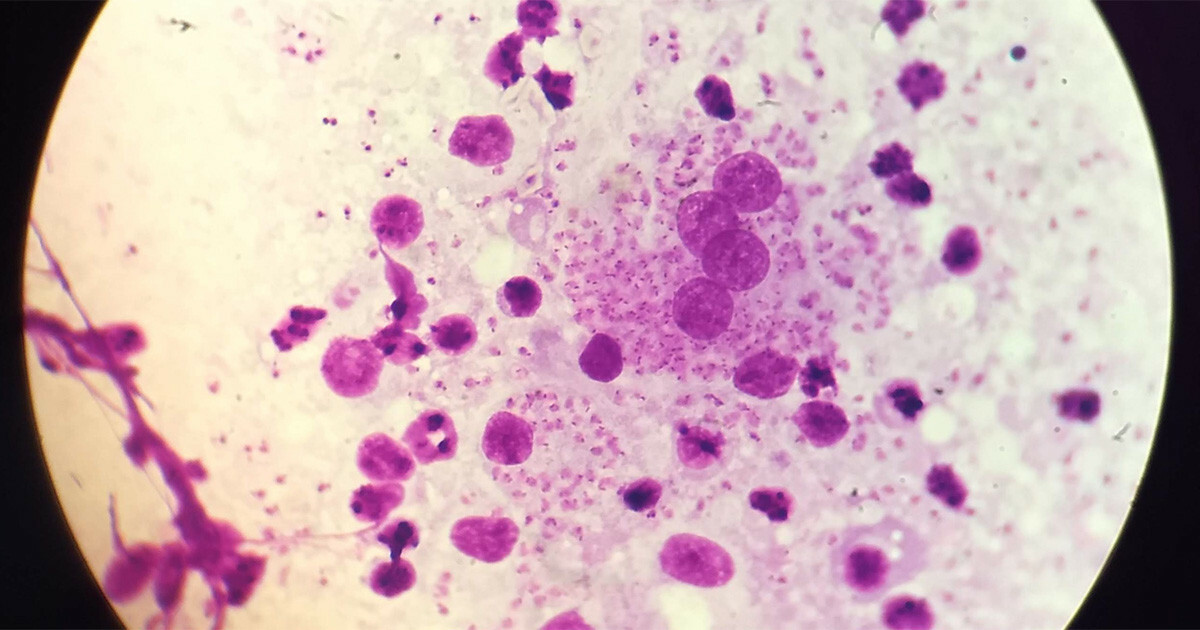 Leishmaniasis | Institute of Tropical Medicine