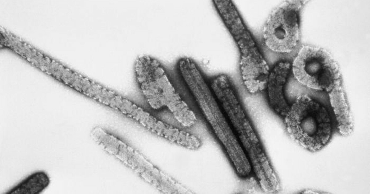 Veelgestelde vragen over het marburgvirus | Institute of Tropical Medicine